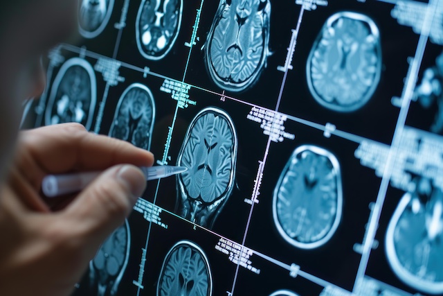 New study uncovers brain circuit responsible for balancing hunger and ...