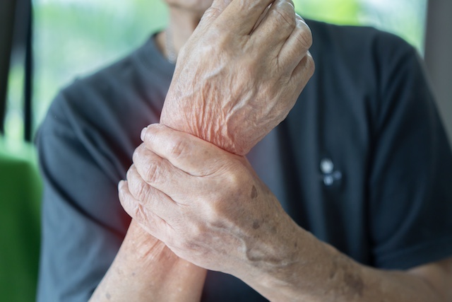 £1.2 million grant fuels development of AI platform for early arthritis detection - CCH